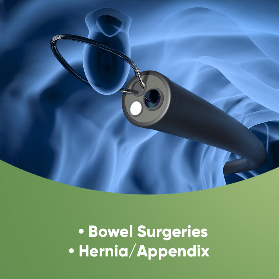 Bowel Conditions & Procedures Overview - Dr Ellis Clark